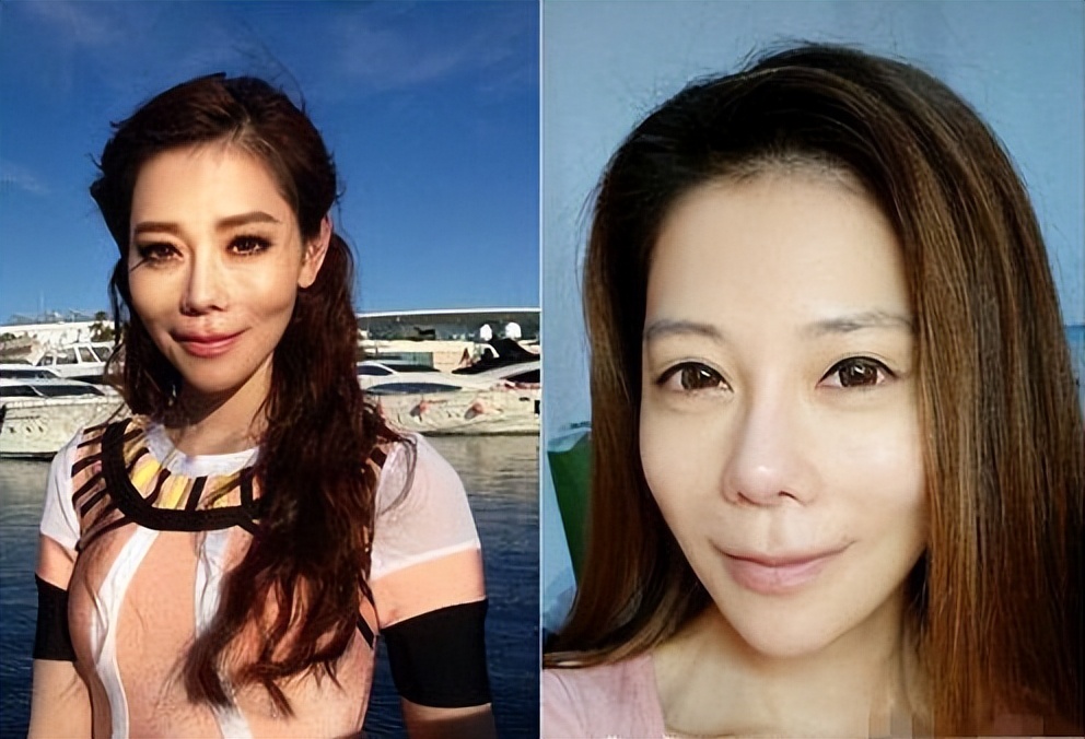 Artists fall in love with plastic surgery: It is very common to cut ...