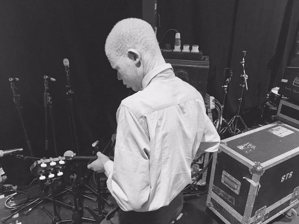 An albino patient who has never sung, sings his life story with a music ...