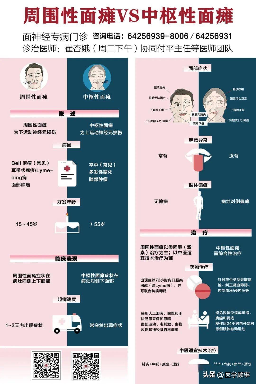 Distinguishing points between central facial paralysis and peripheral ...