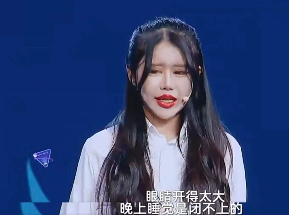 Net red Zhou Chuna spent 4 million plastic surgery!After five years of ...