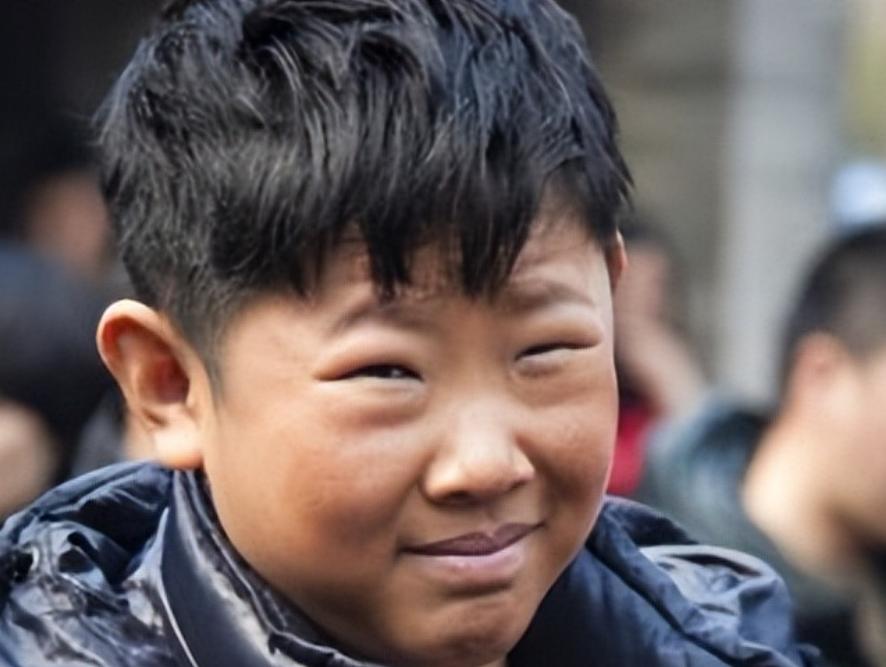 Hou Xiang: He stopped developing at the age of 9, and he can only act ...