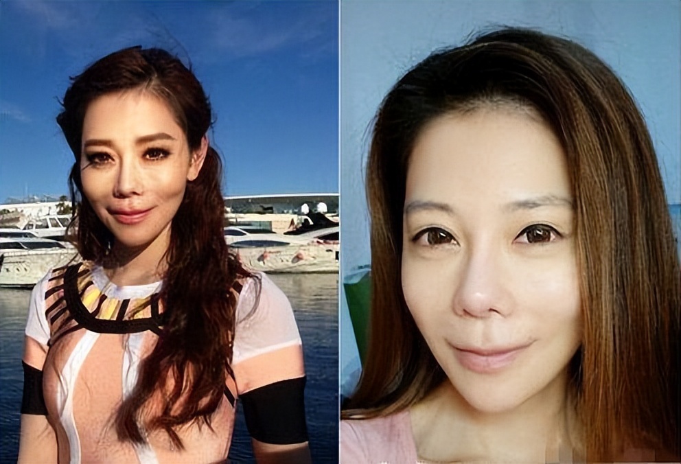 Excessive plastic surgery for entertainers: it is not surprising to have bone-cutting plastic ...