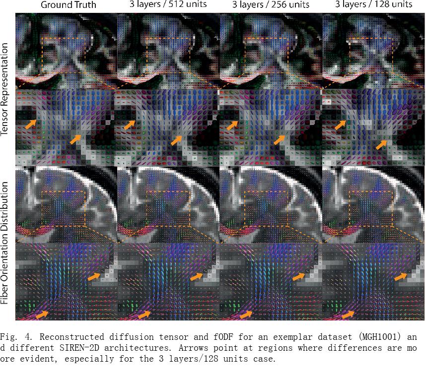 Lossy compression of multidimensional medical images using sinusoidal ...