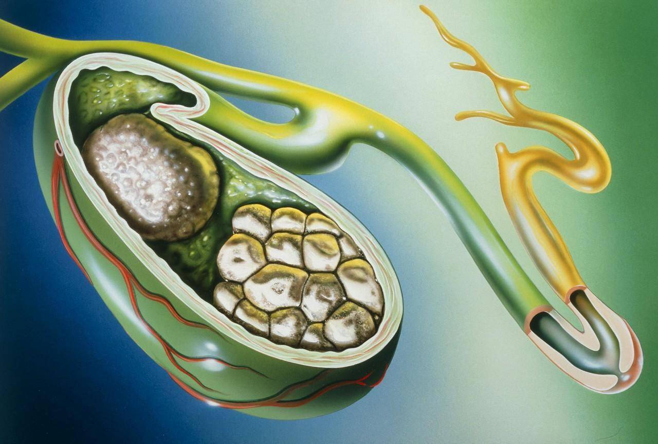 The gallbladder meridian is blocked, the whole body is blocked! One ...