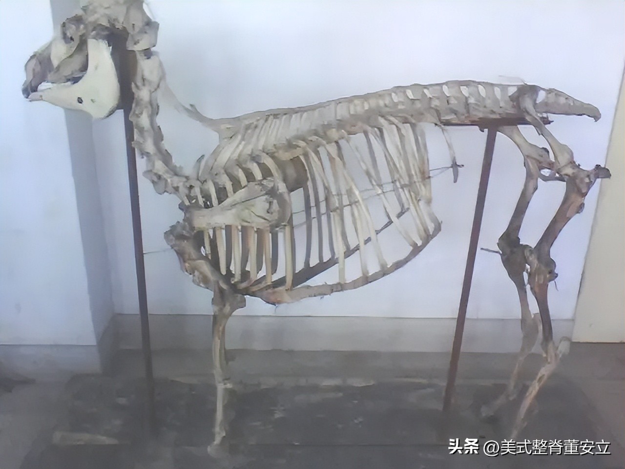 Humpback: Correct the pelvic and cervical spine to solve deep problems ...