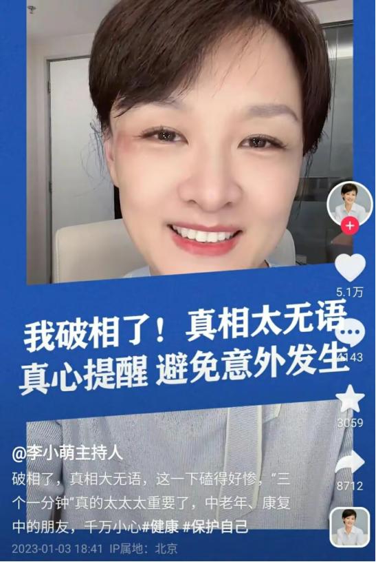 Recent CCTV photos of Li Xiaomeng are worrying!The corners of the eyes ...