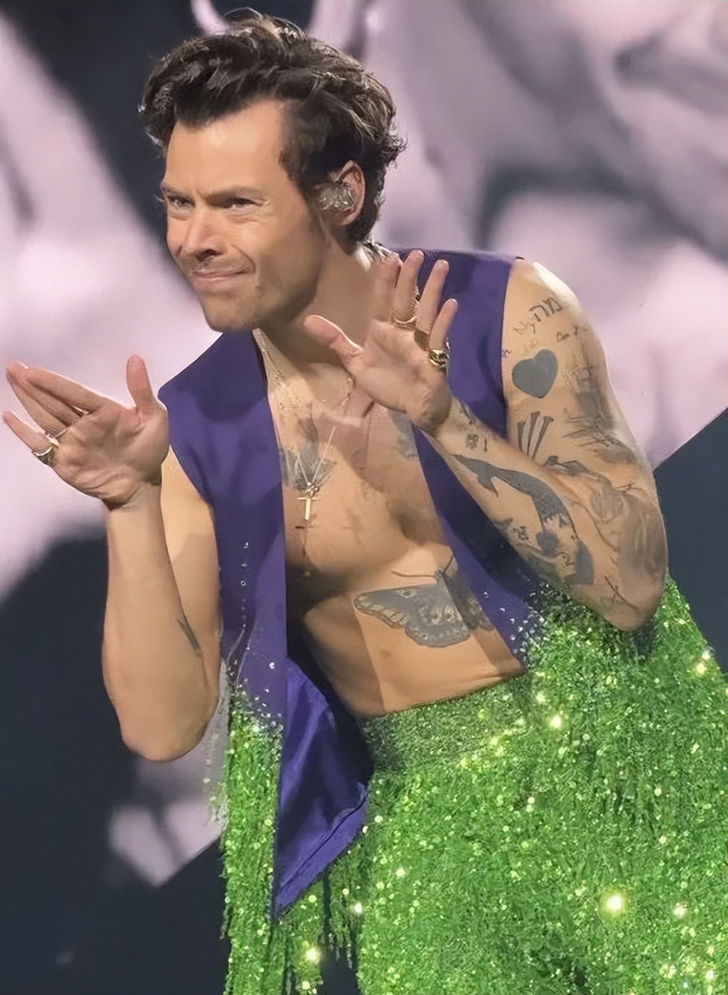 Harry Styles Vienna Concert Attacked, Eye Injured! - iMedia