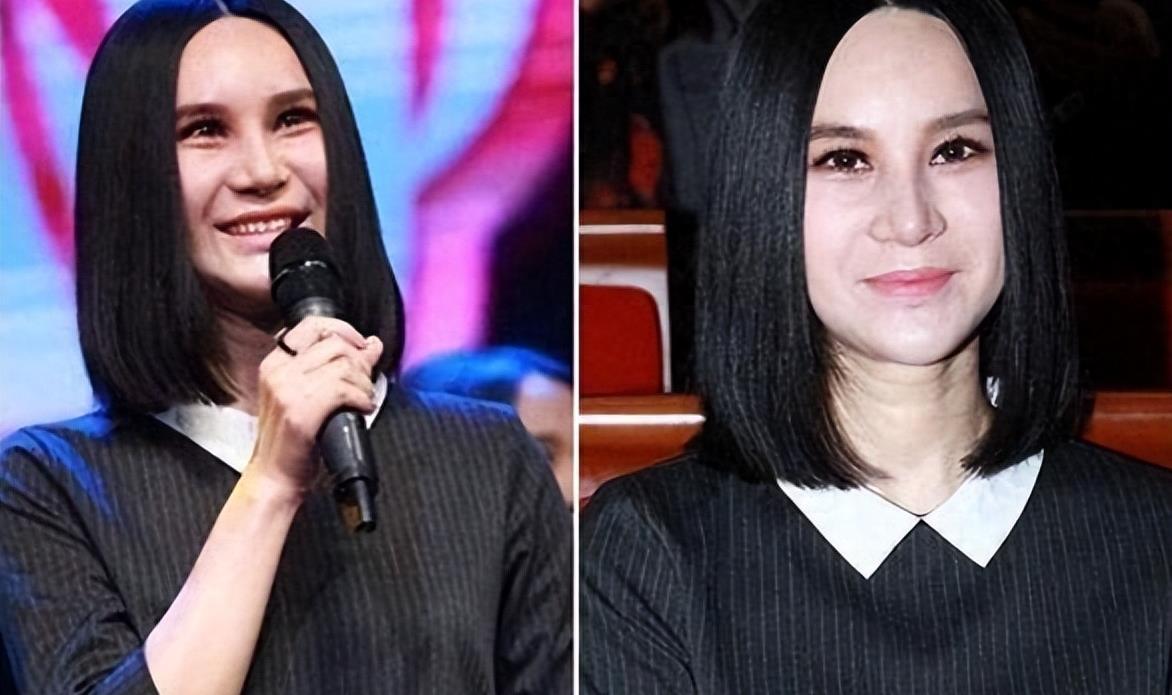 The actress who is addicted to plastic surgery has transformed herself ...