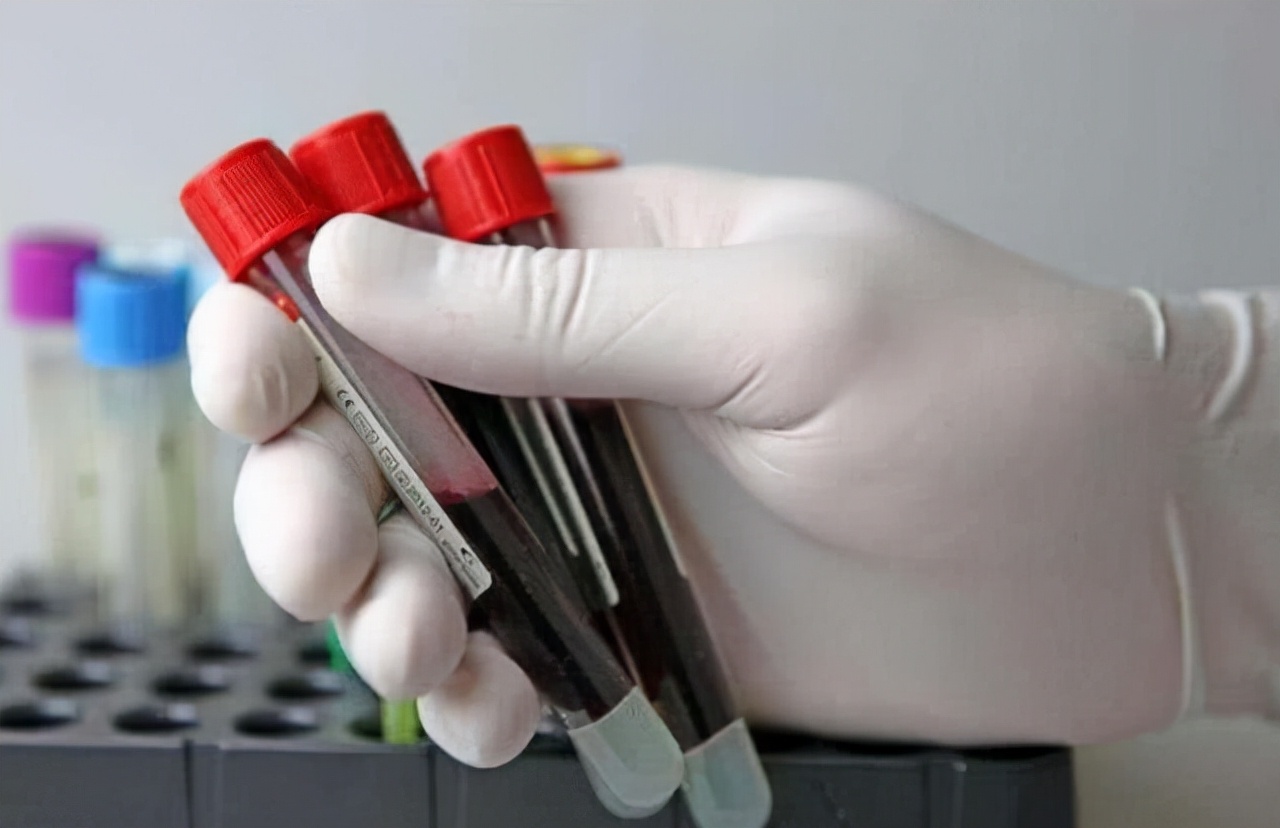 In the blood routine examination, if these 3 indicators are elevated ...