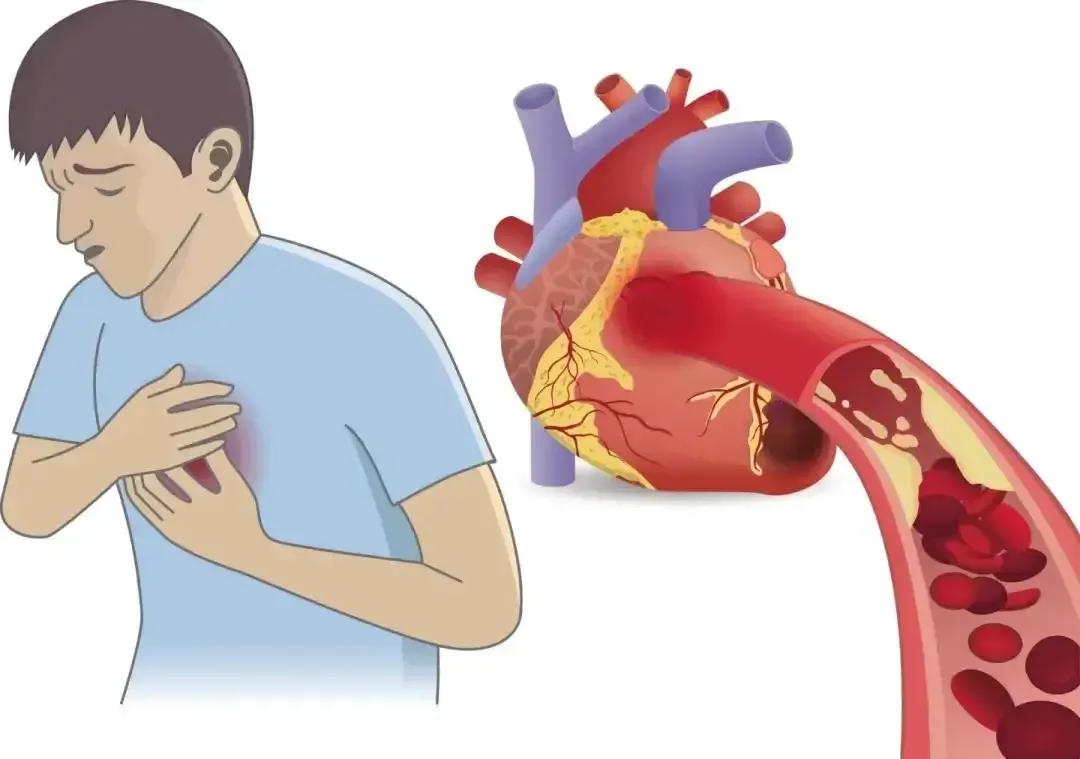 2 medicines to nourish qi and activate blood, remove blood stasis and ...