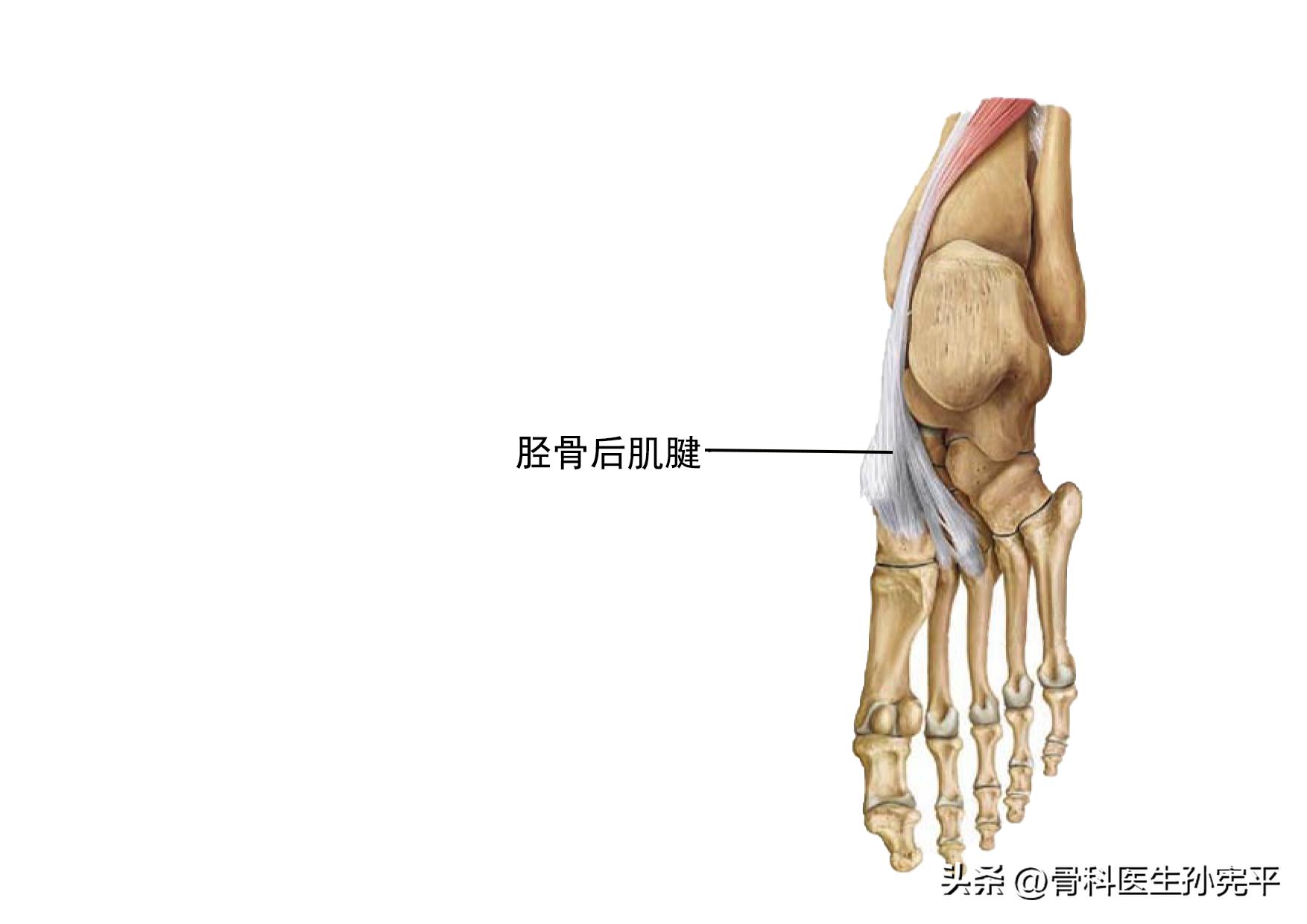 Sharing of Medical Imaging Pictures (31) - Outer Tibia/Scaphoid ...