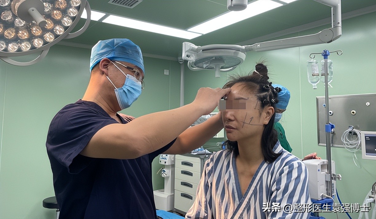 47-year-old temporal facelift + facetite full record, 67 days of effect ...