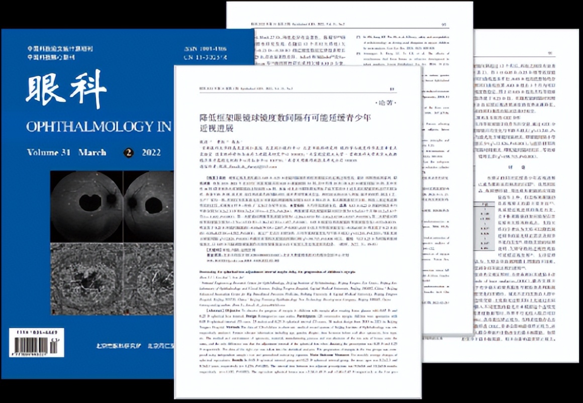 Archimedes 5-degree lens: domestic digital anti-fatigue lens ceiling ...