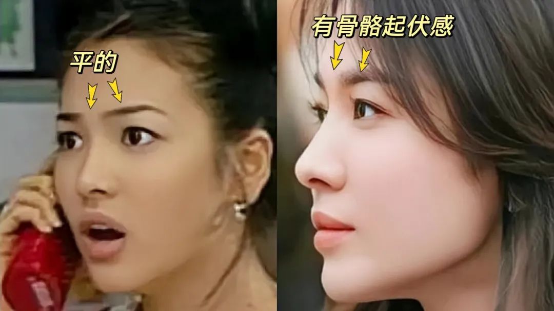 The impact of the three-dimensionality of the T zone on the value of ...