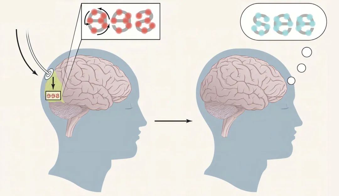 Brain-computer interface and visual prosthesis - iMedia