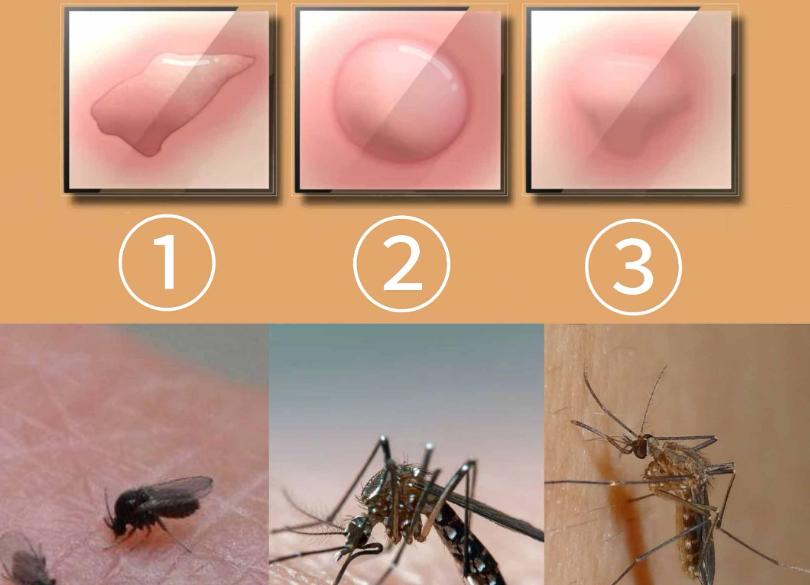 Why do mosquitoes choose to bite you? Uncover the hidden reason! - iNEWS