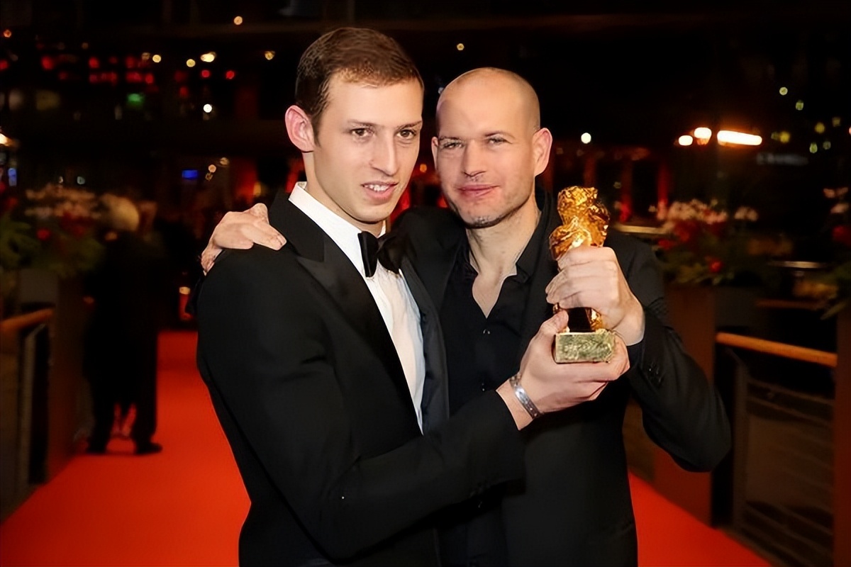 29-Year-Old Israeli Actor Goes Bald in His Twenties With Hair ...