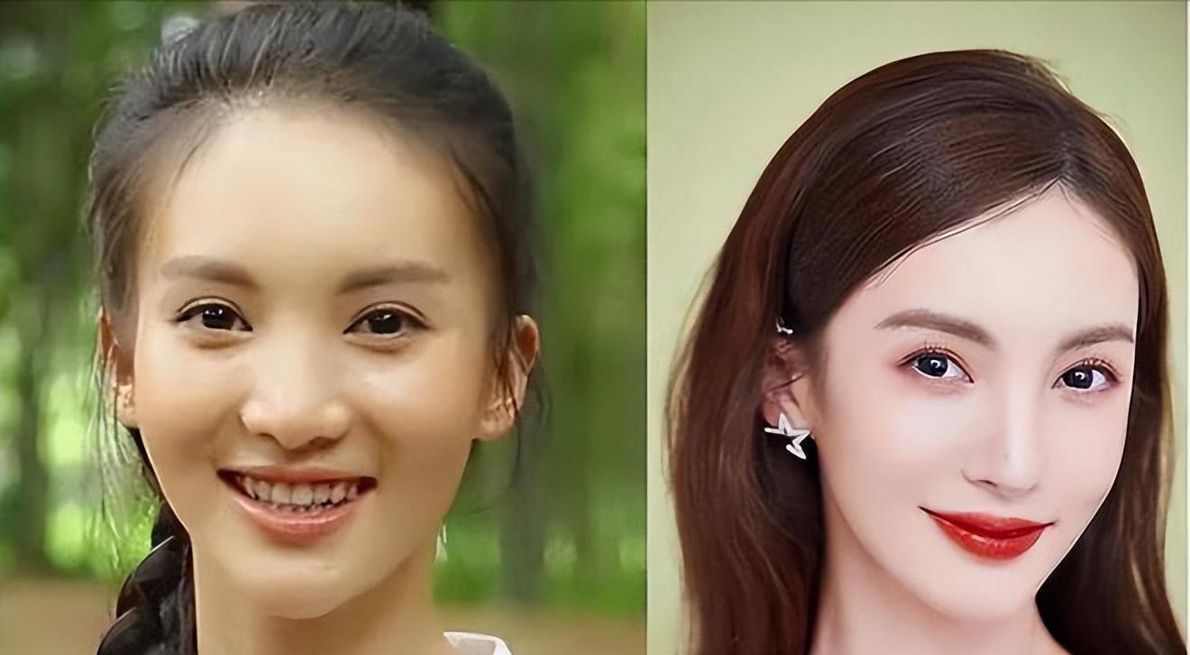She looks completely different before and after plastic surgery, yet ...