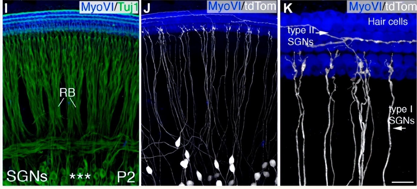 Semaphorin-3F-mediated repulsion promotes inner hair cell innervation ...