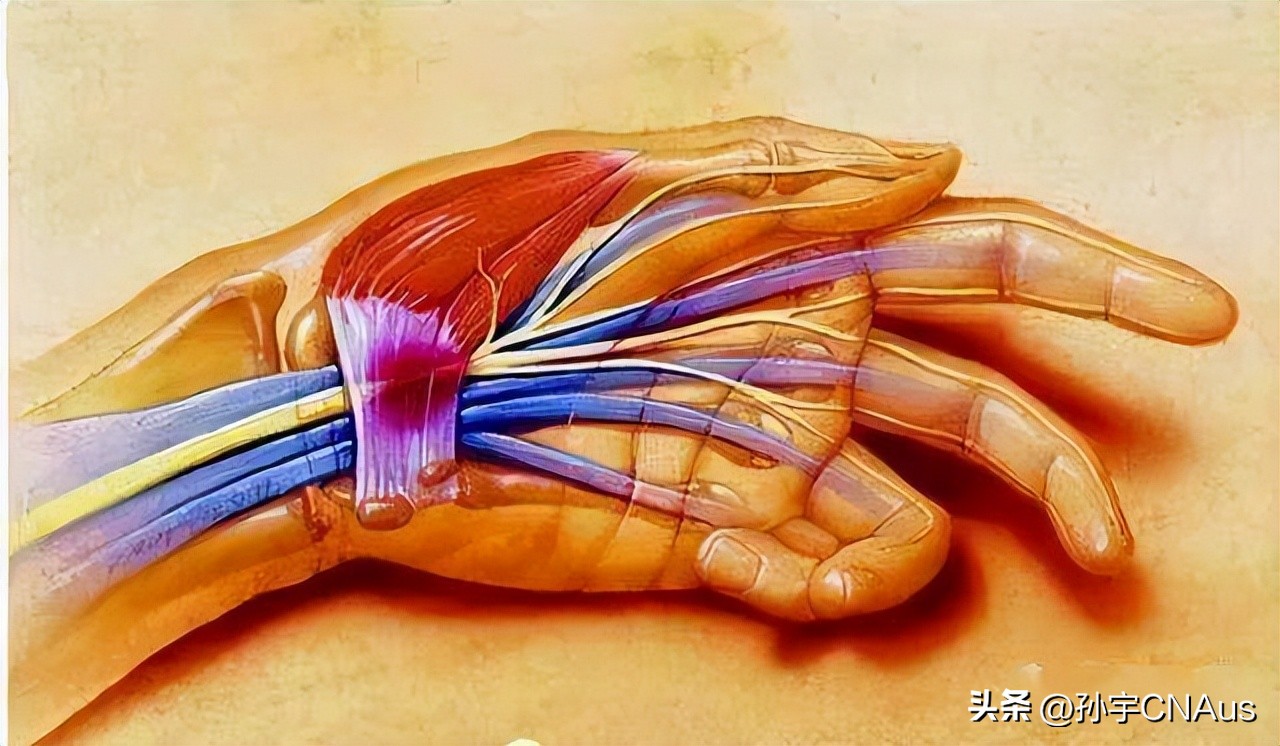 How to train to avoid injury?Only by walking well can we go far - iNEWS