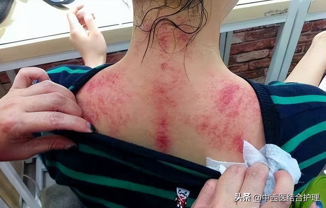 [Traditional Chinese Medicine Health Preservation] Why do you need to ...