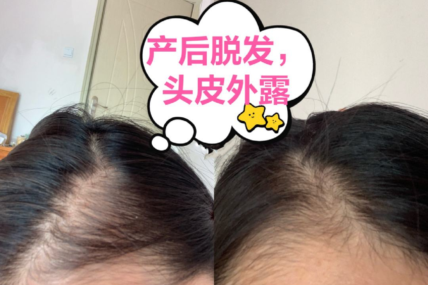 Ma Li revealed that the internal organs were damaged, sneezing and ...