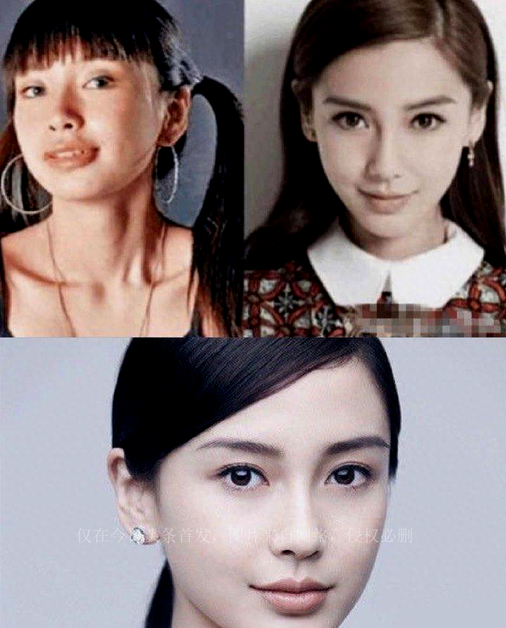 The "stubbornness" of celebrities means that they don't have plastic ...