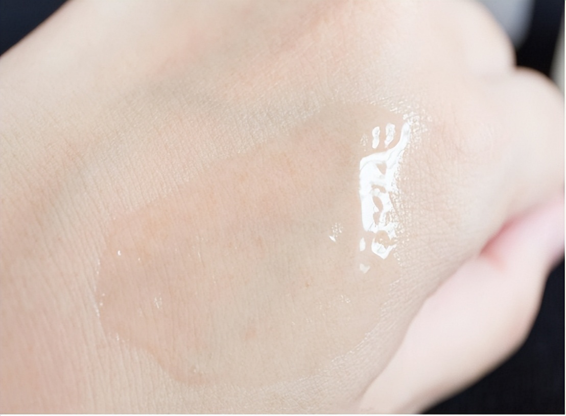 What is the cause of peeling hands and ringworm?How to heal quickly ...