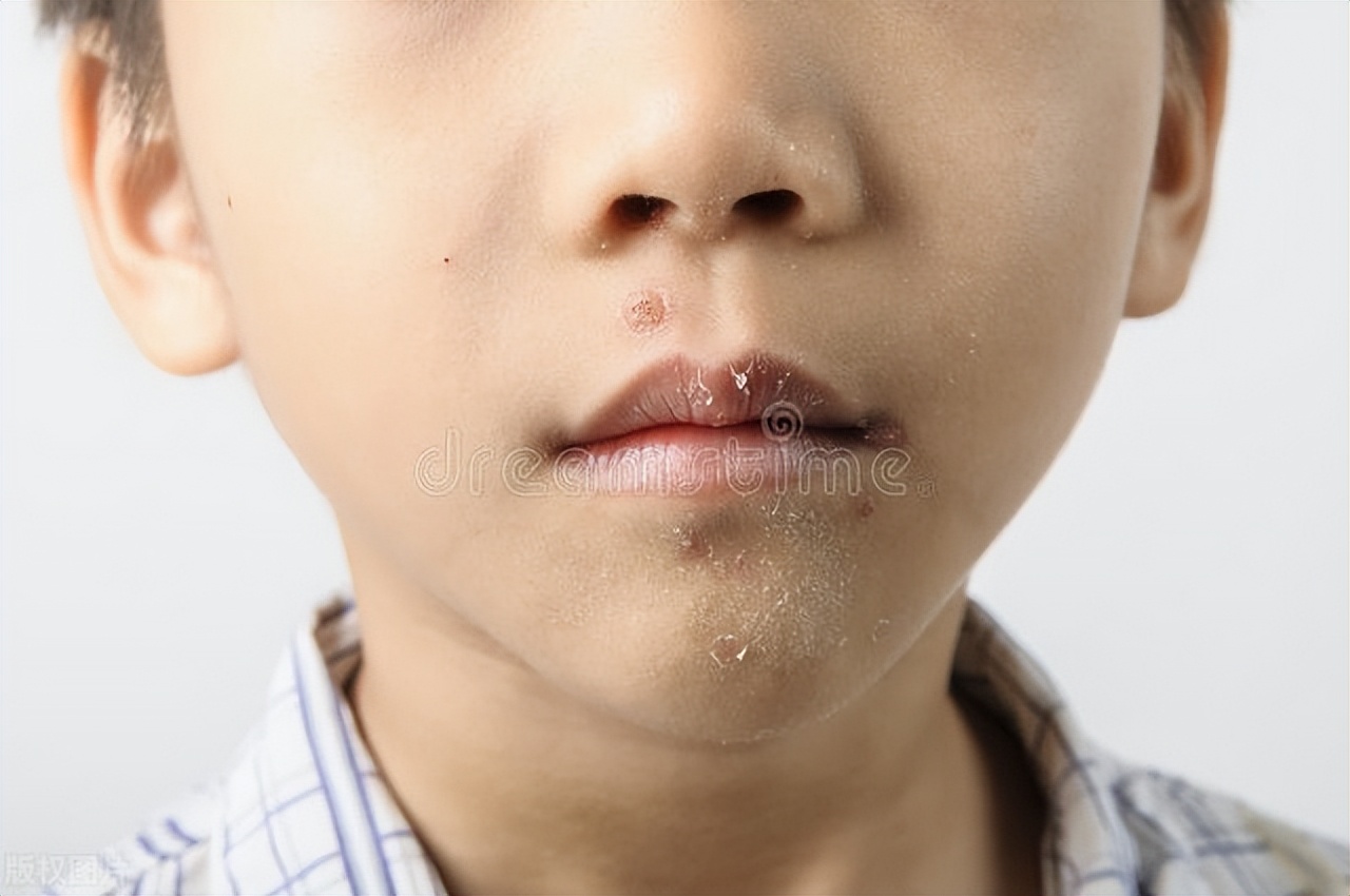 Mouth always dry at night? Don't just think it's water shortage, beware ...
