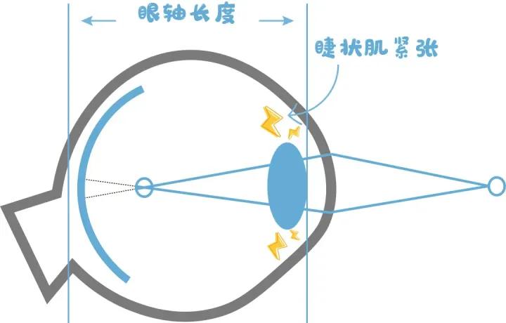 What is a dilated (dilated pupil) optometry?Is mydriasis harmful to the ...
