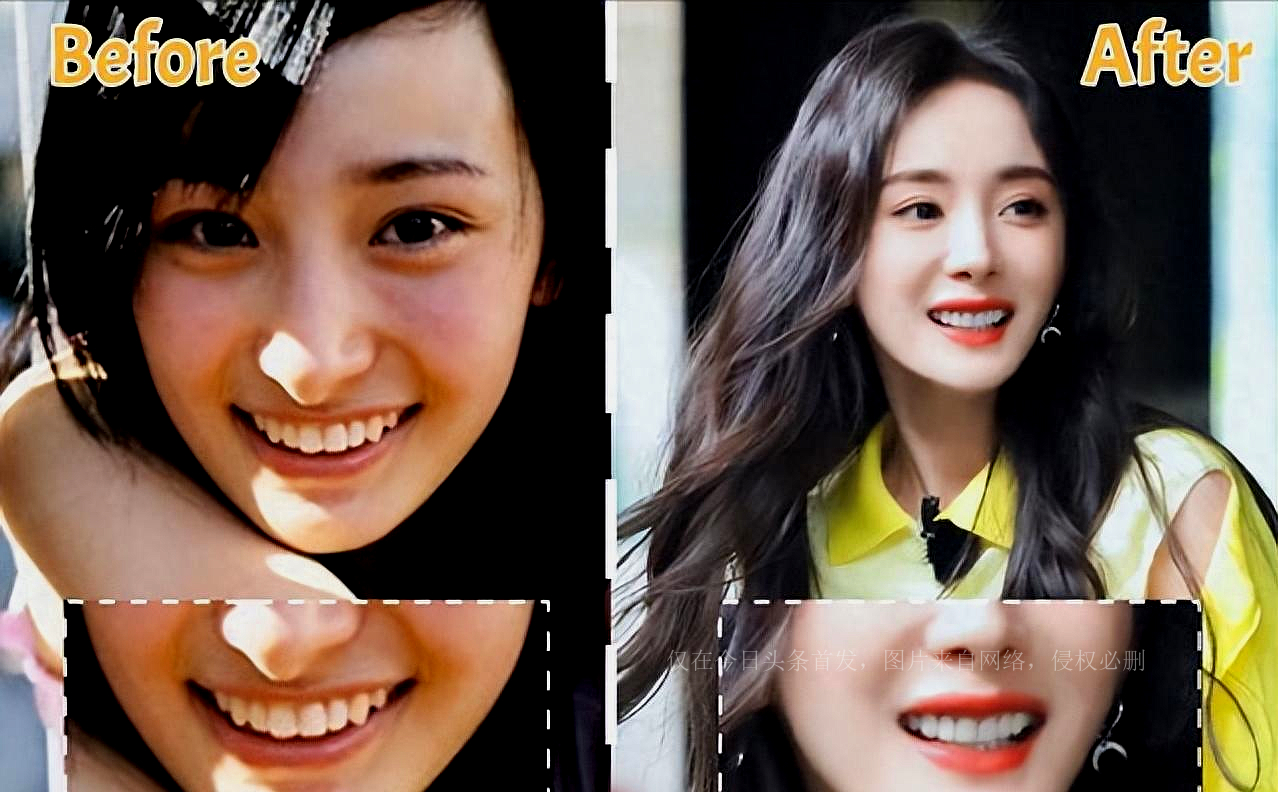 One mouth "ruins" the entire face. These 7 celebrities tell you that a ...