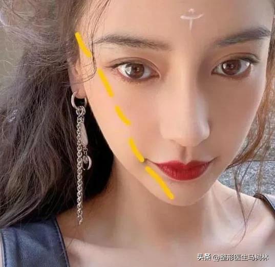 The higher the degree of facial folding, the more advanced the face ...