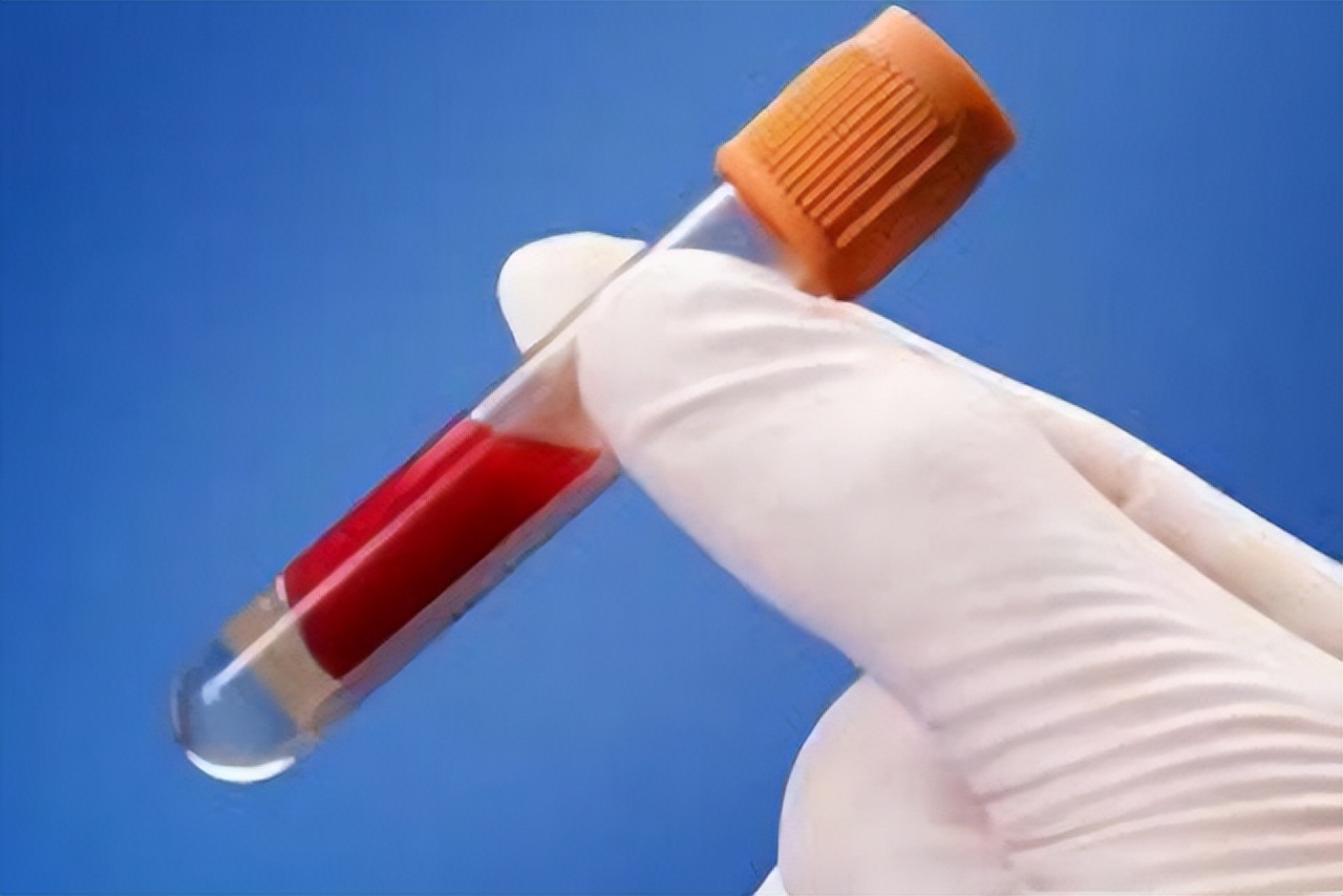 In the blood routine examination, if these 3 indicators are elevated ...