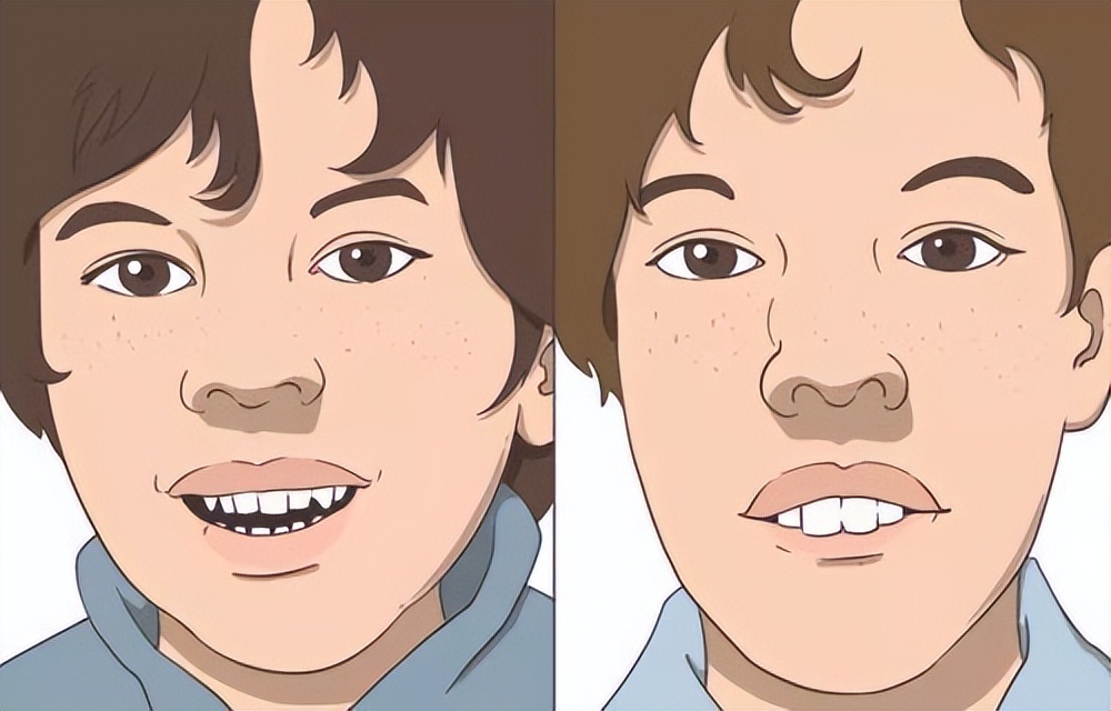 What are the treatments for adenoid hypertrophy in children? - iNEWS