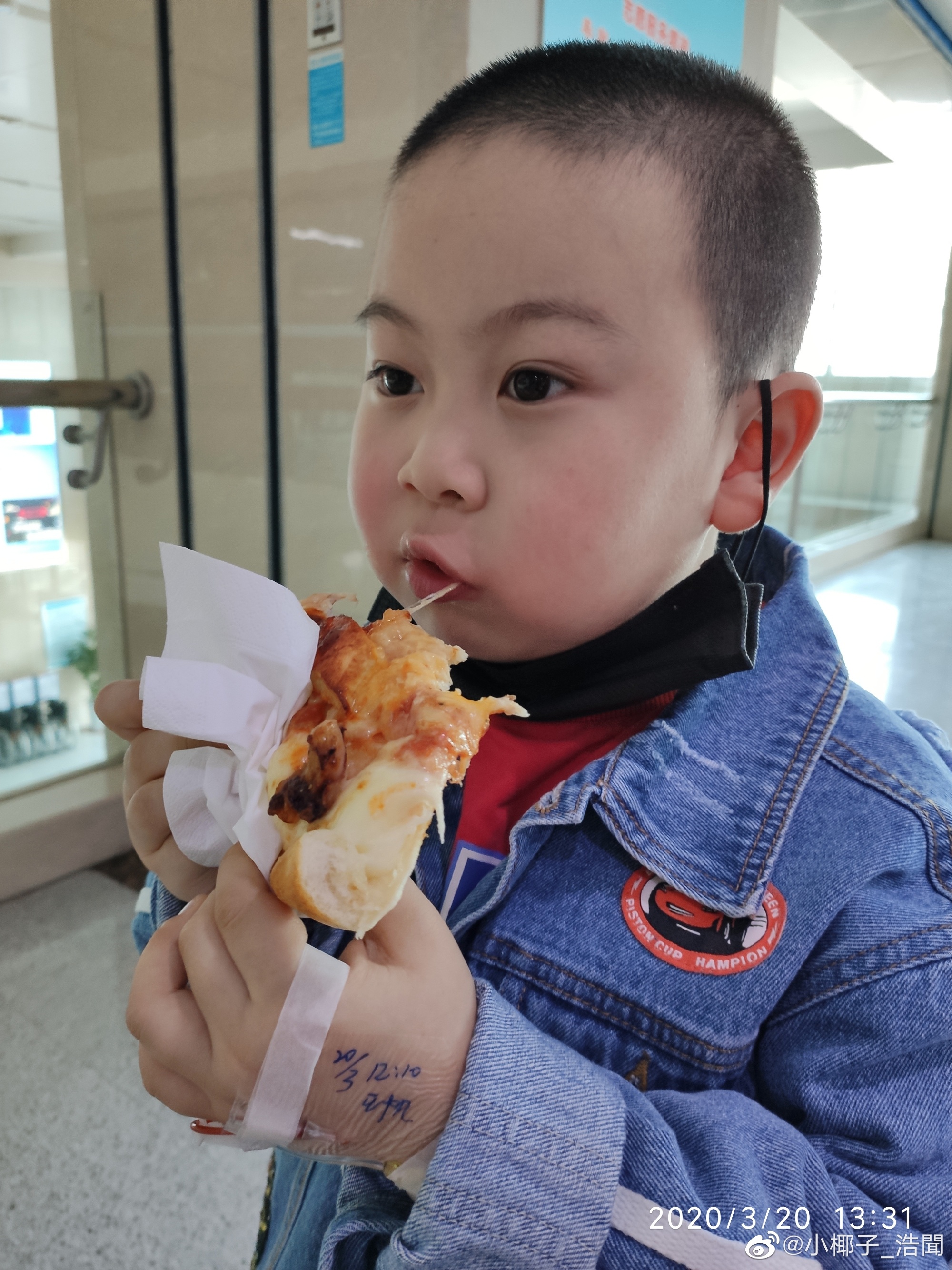 Children's experience of adenoid surgery and comparison before and ...