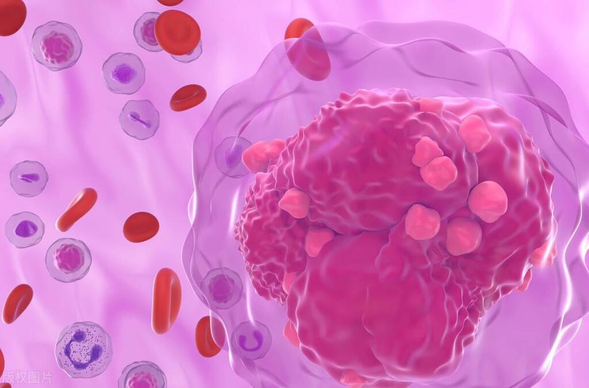 What Causes Lymphoma? - iMedia