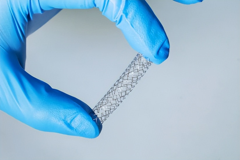 The world's first iron-based absorbable stent approved - iMedia