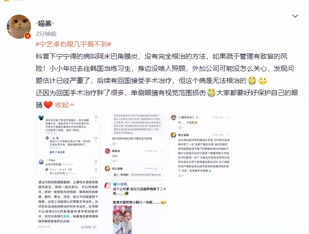 The female artist revealed that her right eye is almost invisible, and ...