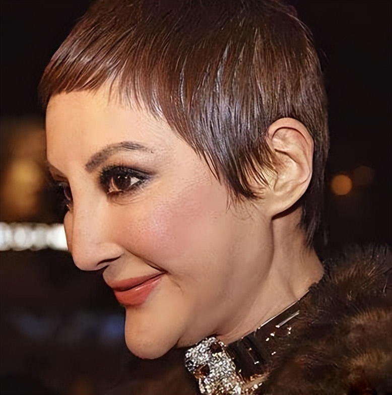 The competition of fancy fake chins in the entertainment industry is ...