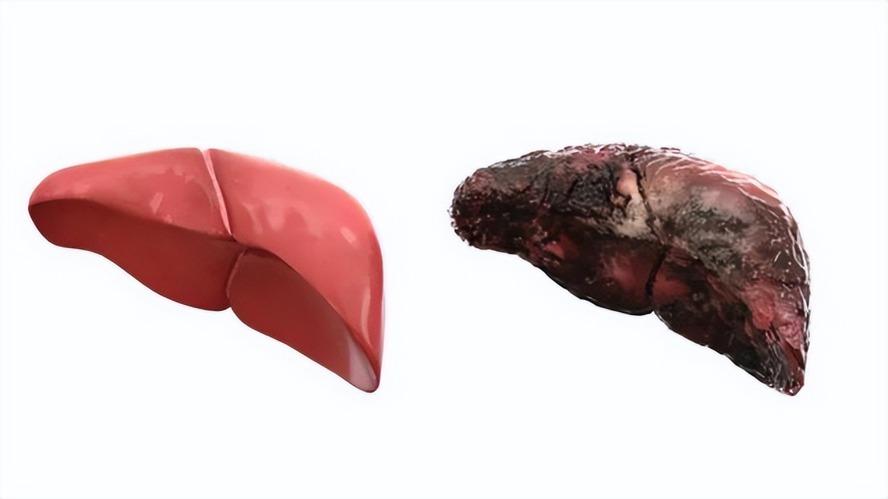 In spring, eat more of these 2 kinds of natural "liver-nourishing ...