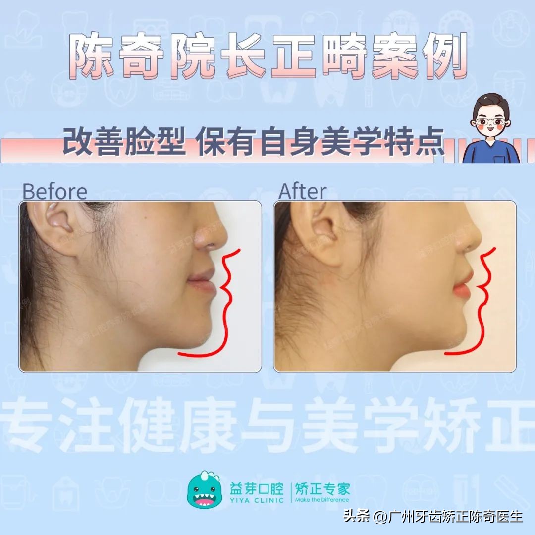 Overhead + open jaw, a 27-year-old little fairy transformed gracefully ...