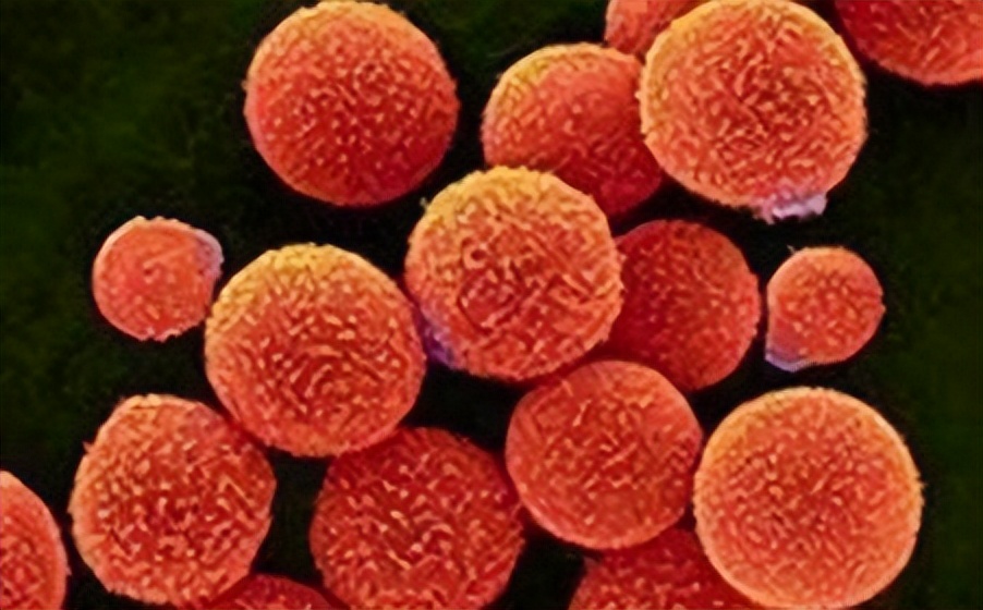 Exploring the protein evolution and bactericidal process of ...