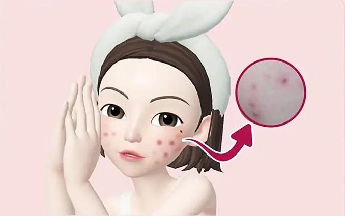 Kunming Skin Management Center: What causes acne pits?How long does it ...