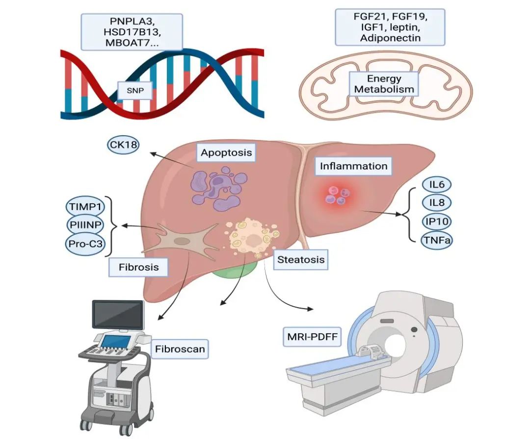Creating a Noninvasive Prediction Model for NAFLD in China Based on MRI ...