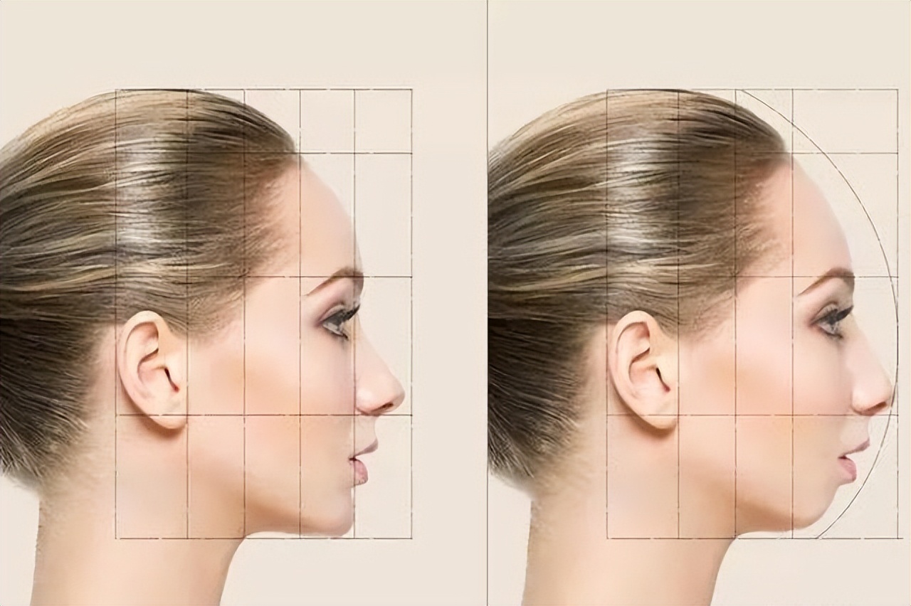 Do you have a "protruding mouth" tendency?It's no wonder that the ...