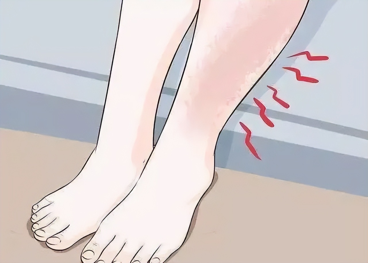 Whole body edema in the advanced stage of cancer has not improved?Maybe ...