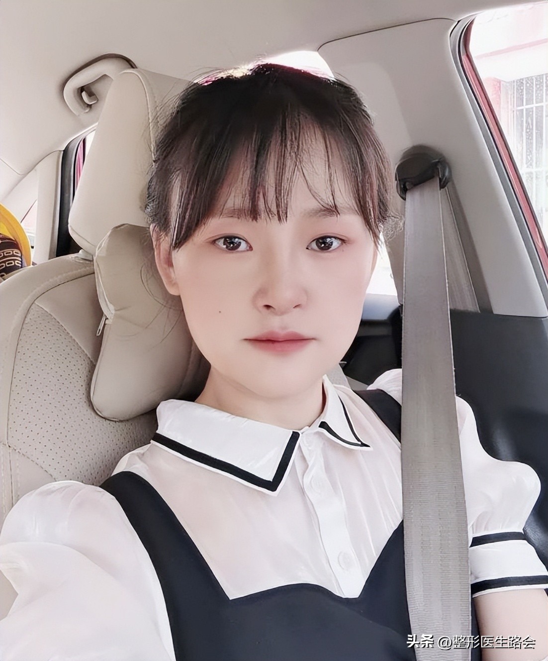 A 27-year-old girl with a saddle nose went to Beijing for a full-body ...