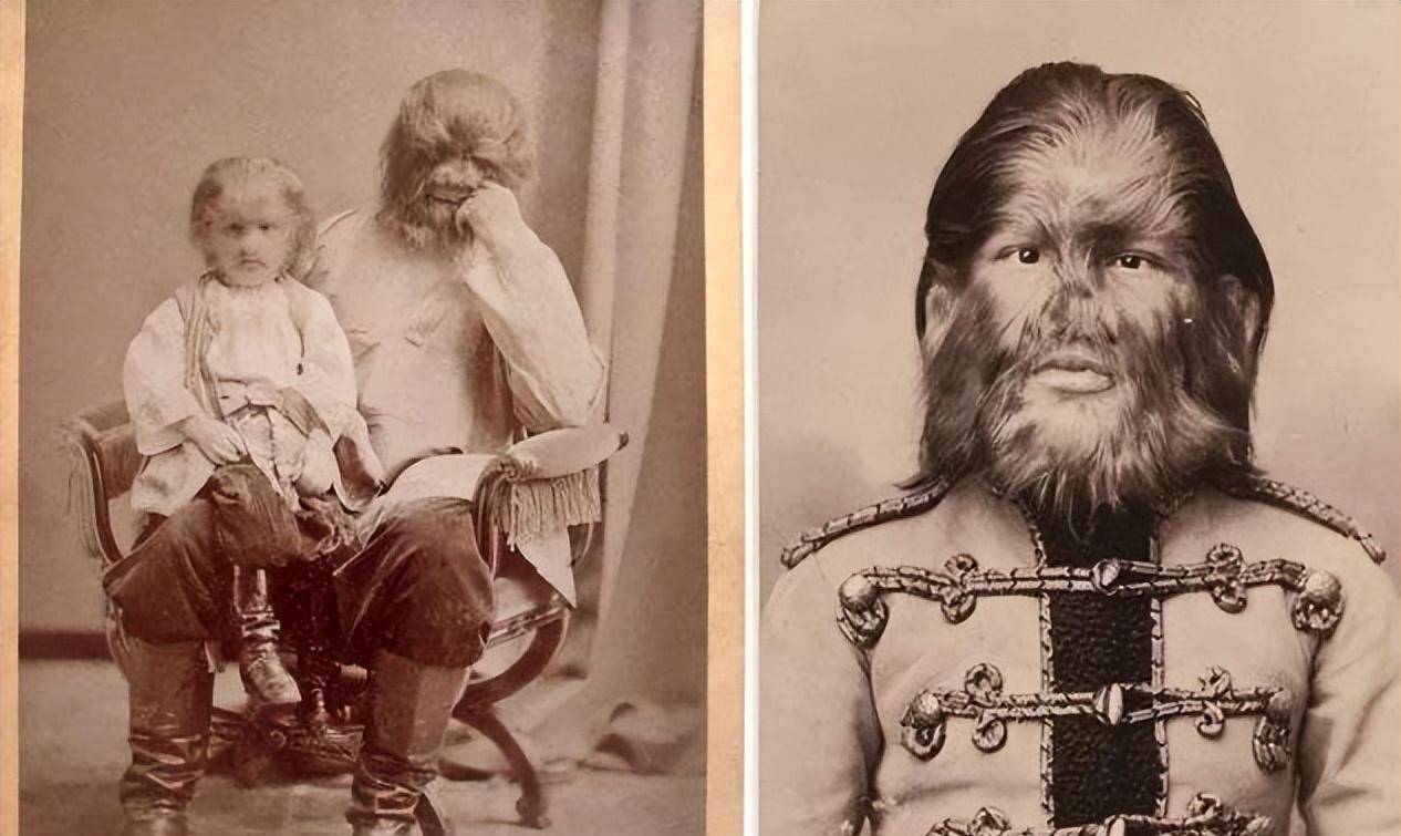 "Freak" love story!Hunting for 'Freak Show' Stars, 'Monkey Woman' and ...