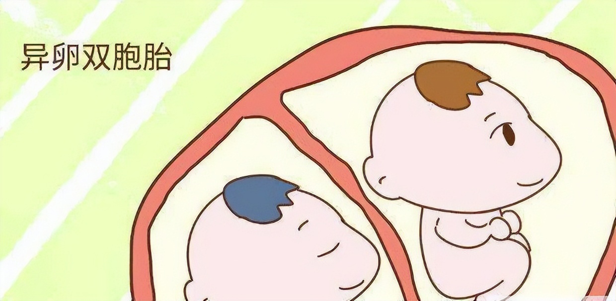 World's first pair of half-twins with 2 eggs implanted at the same time ...