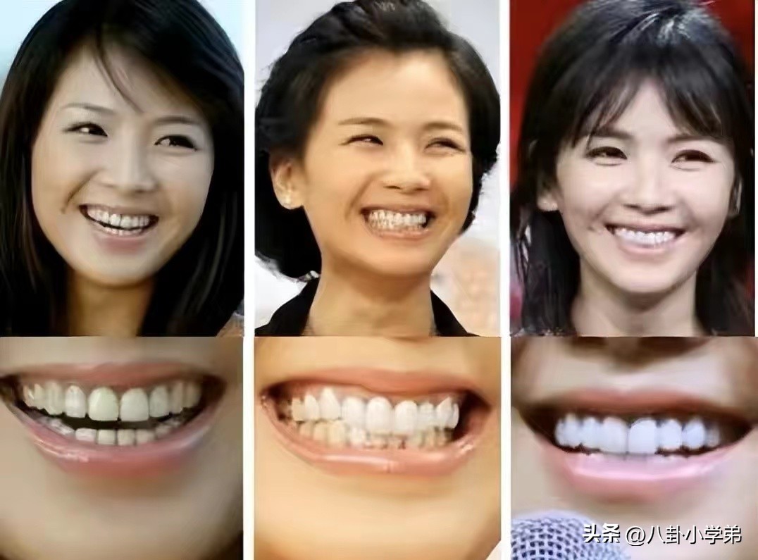 In the entertainment industry, each person has a pair of porcelain ...